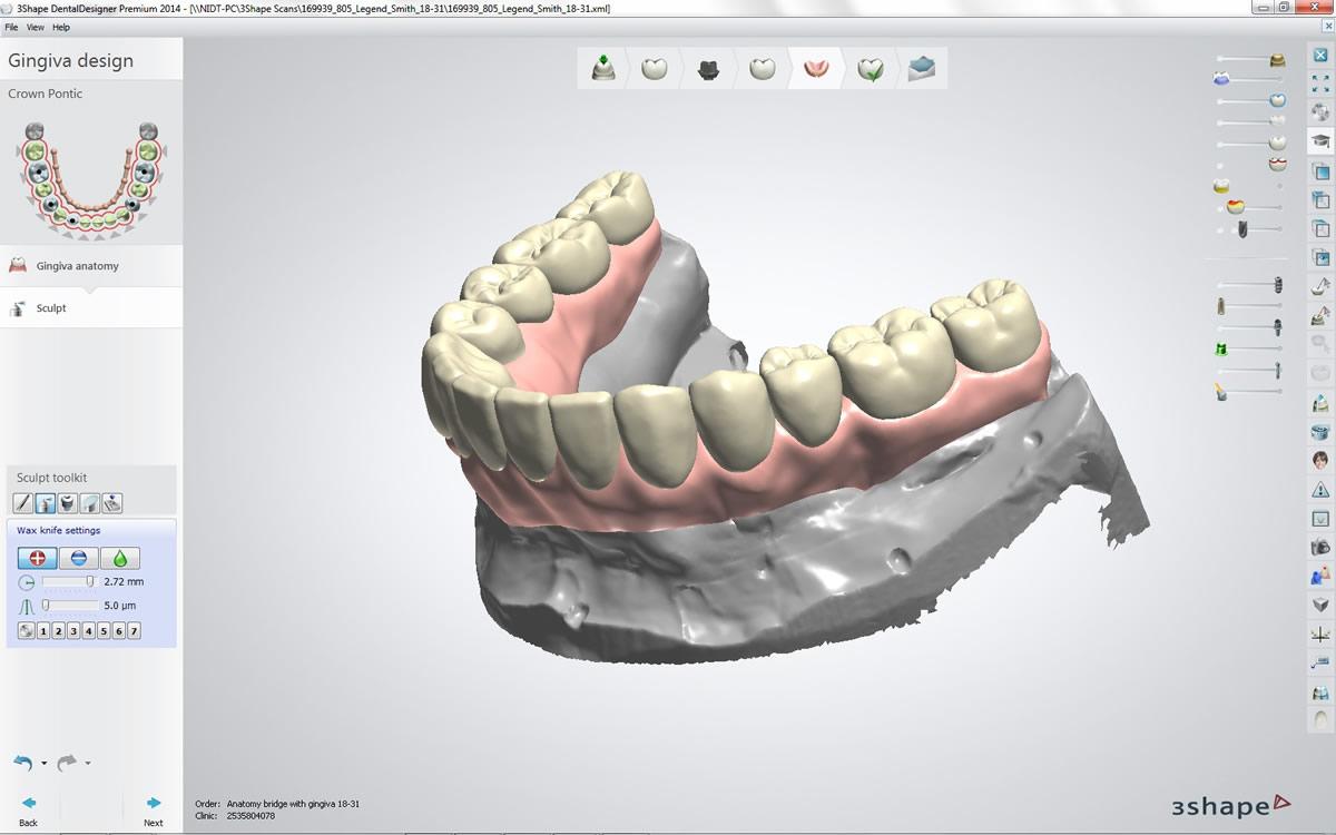 Tecnología 3D en odontología – Centro Dental Cise